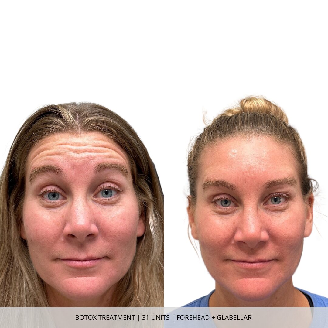 Before And After Gallery | Fargo Wellness District